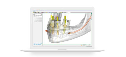 Simplant Pro 18 – ZWP online – das Nachrichtenportal für die Dentalbranche